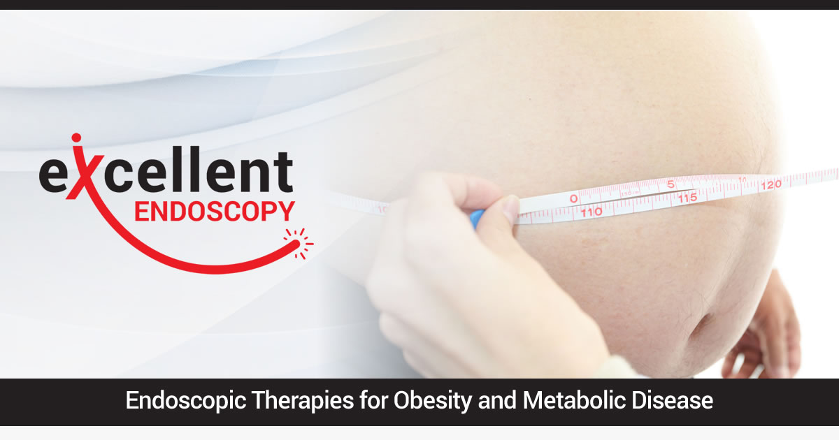 Endoscopic Therapies for Obesity and Metabolic Disease - News ...