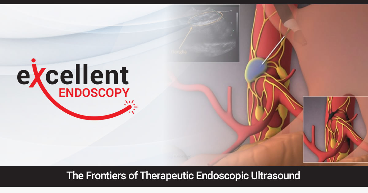 The Frontiers of Therapeutic Endoscopic Ultrasound - News / Articles ...